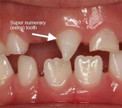 Folsom Oral Surgery And Implant Center | Folsom